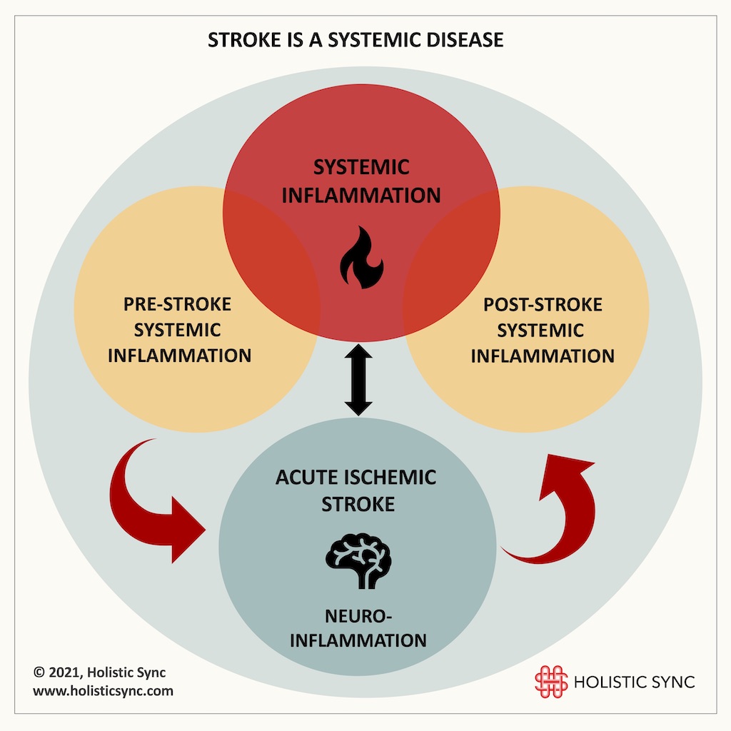 The association between inflammation and Pre- and Post-Ischemic Stroke